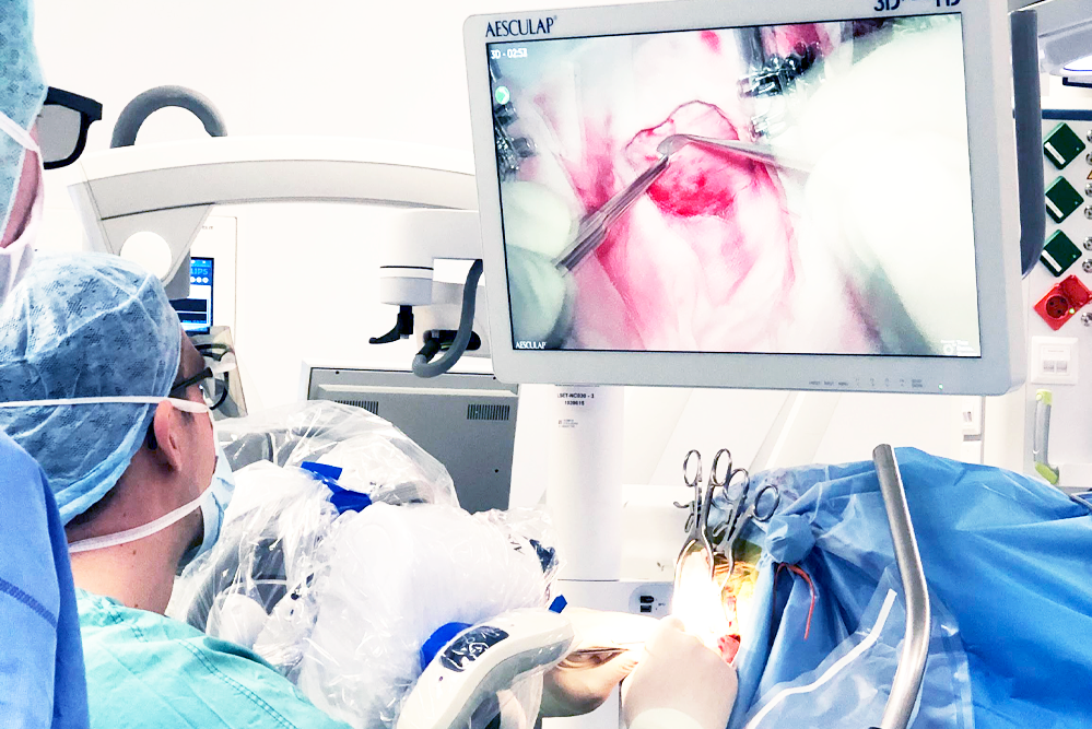 True Digital Surgery (TDS) | Digital Surgical Microscope Technology